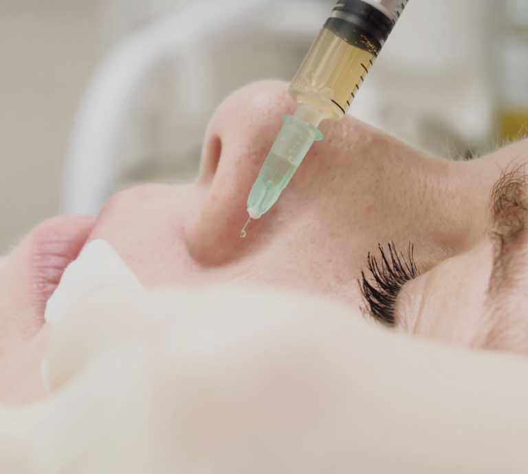 MESOGLOW - GHDERMA Dr. Héctor Valdebenito Médico Cirujano