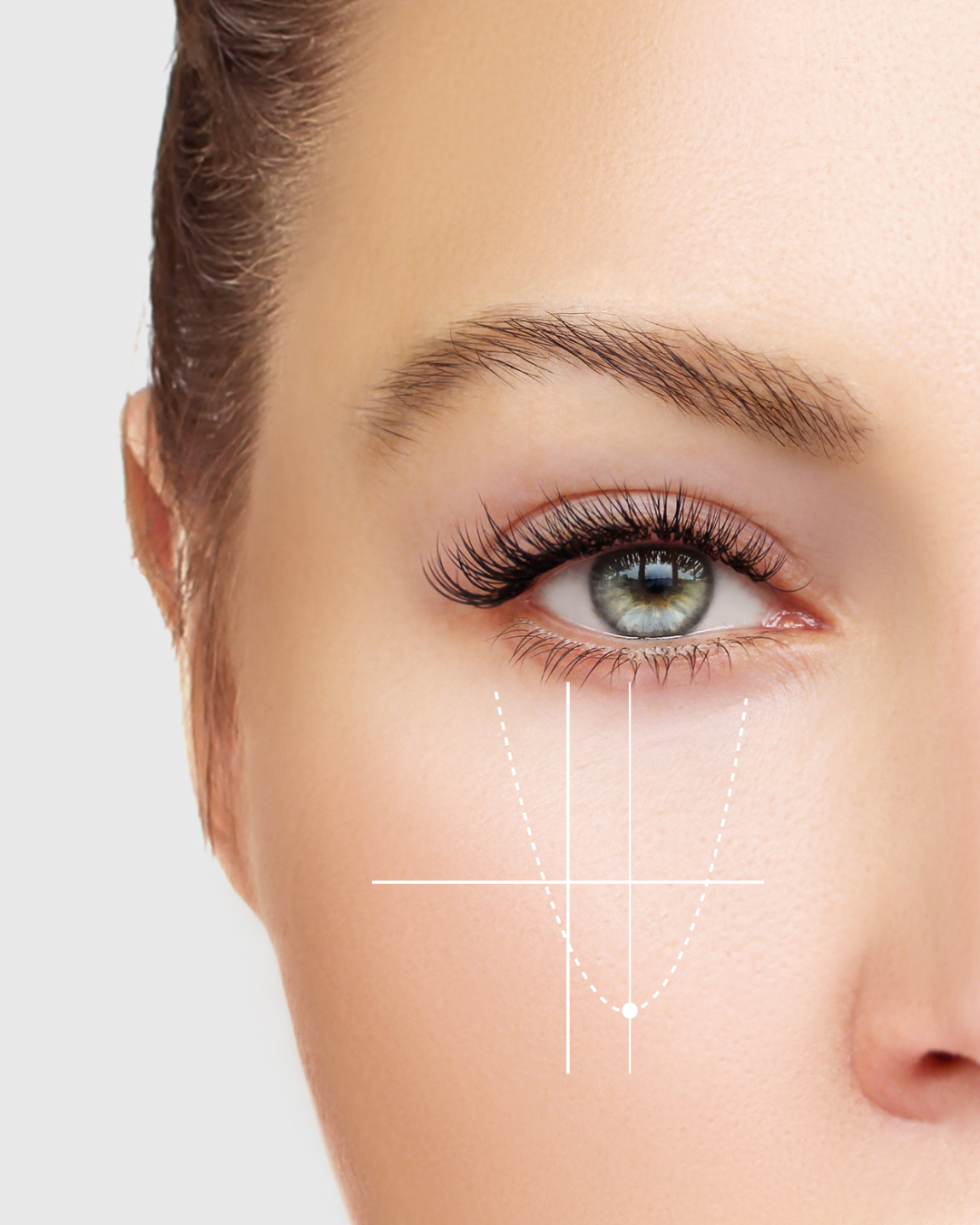 Nucleofill Eyes Tratamiento zona periocular 2 sesiones - GHDERMA Dr ...